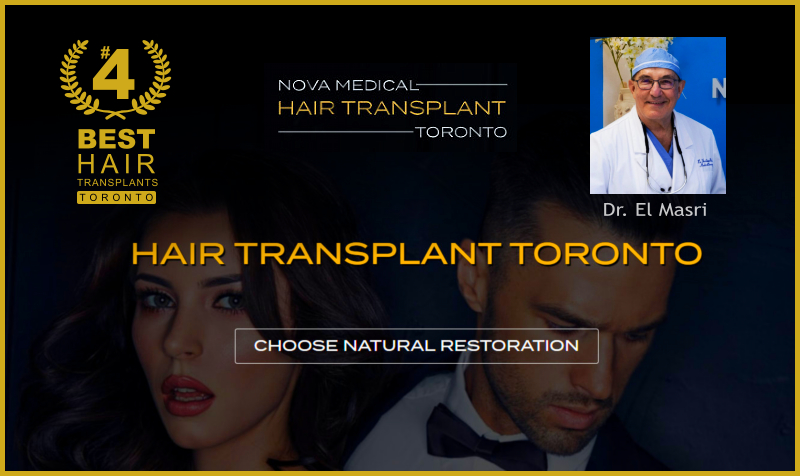 Best Hair Transplants – Best Hair Transplant Toronto